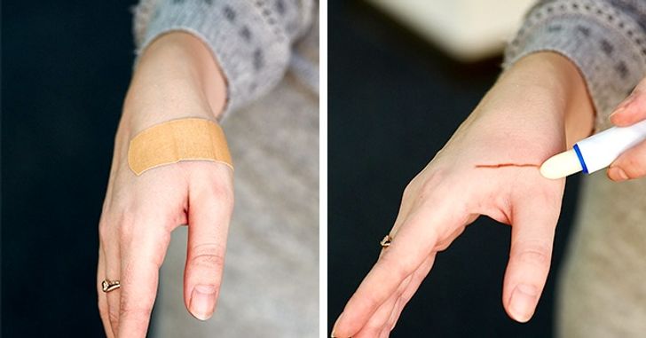 Healing insect bites and minor cuts – Smart Mindsets